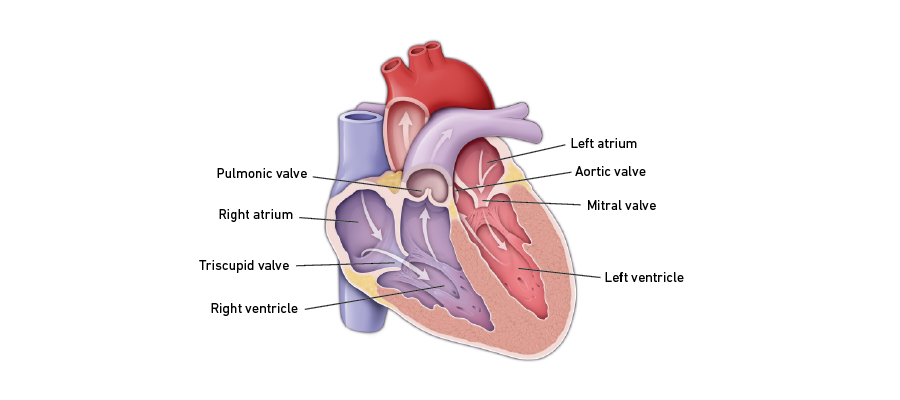 Aortic Valve Stenosis | Temple Health Aortic Valve Stenosis | Temple Health