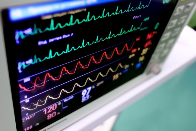Heart Arrhythmias: Causes, Symptoms, and Treatments | Temple Health Heart Arrhythmias: Causes, Symptoms, and Treatments | Temple Health