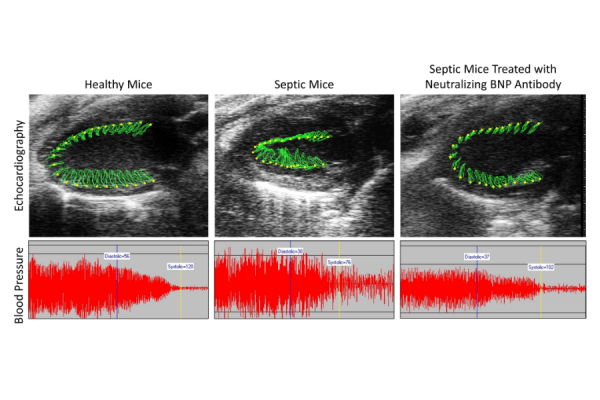 Temple Researchers Show Protein Produced By Heart in Sepsis Lowers ...